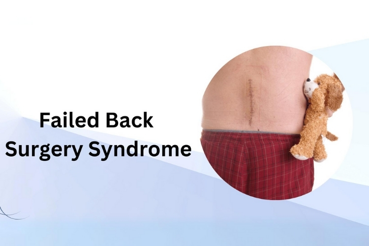 Failed Back Surgery Syndrome - Fønixen Spine Pain