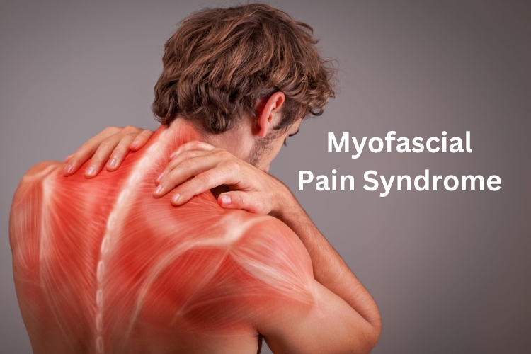 Understanding Myofascial Pain Syndrome – WHBNXF