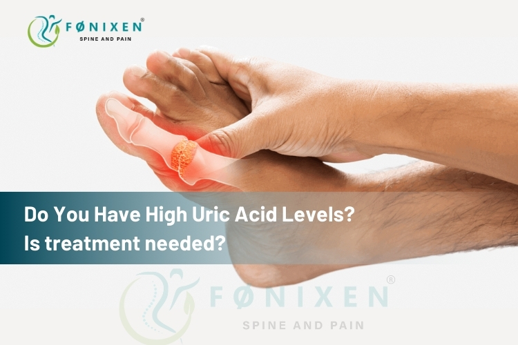 Do You Have High Uric Acid Levels? Is treatment needed? - Fønixen Spine ...