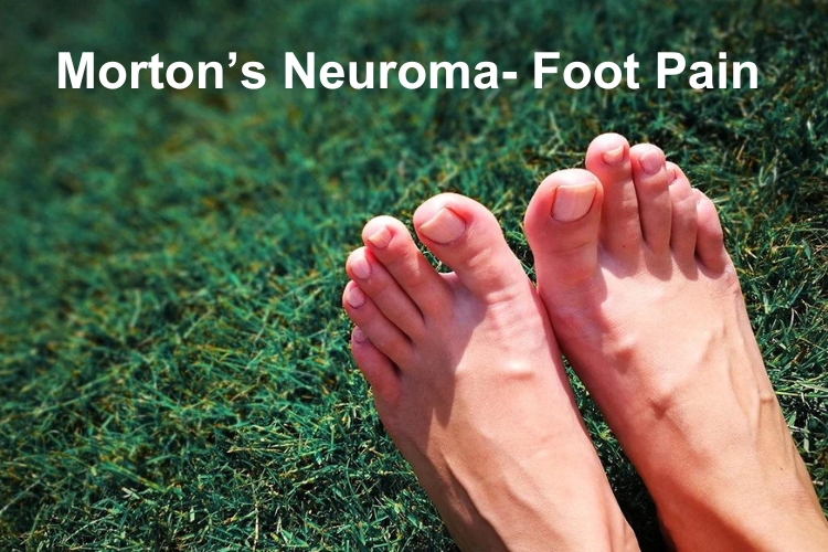 Morton's Neuroma- Foot Pain - Fønixen Spine Pain